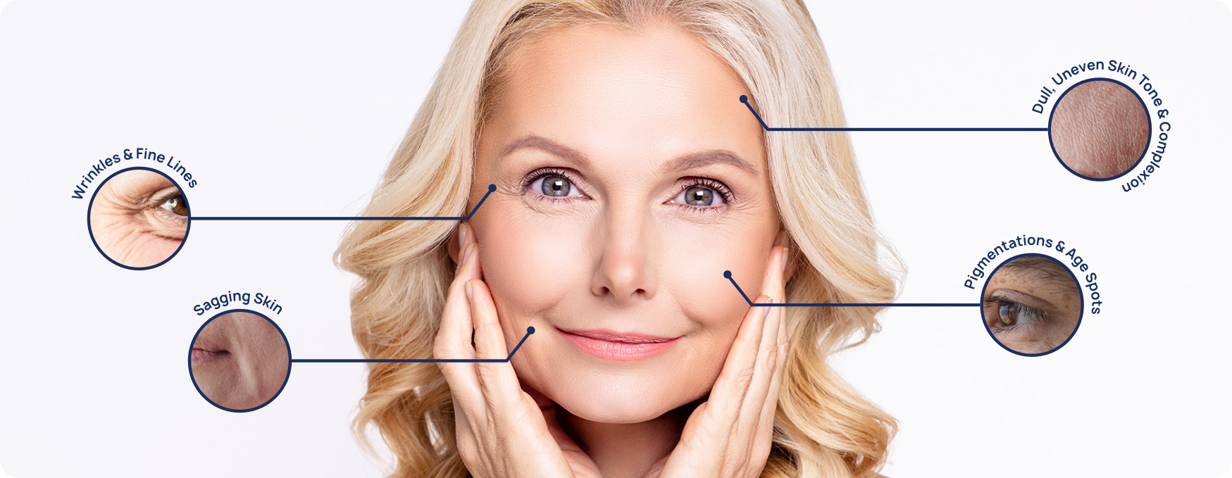 Aging Skin - Ko Skin Specialist